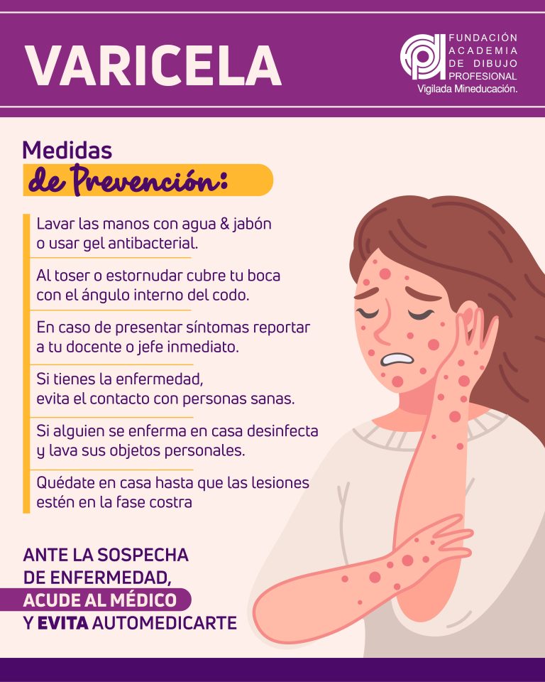 Prevención de la Varicela - Fundación Academia de Dibujo Profesional